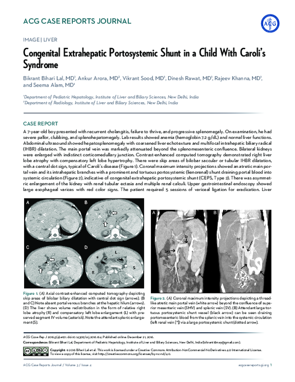 (PDF) Congenital Extrahepatic Portosystemic Shunt in a Child With ...