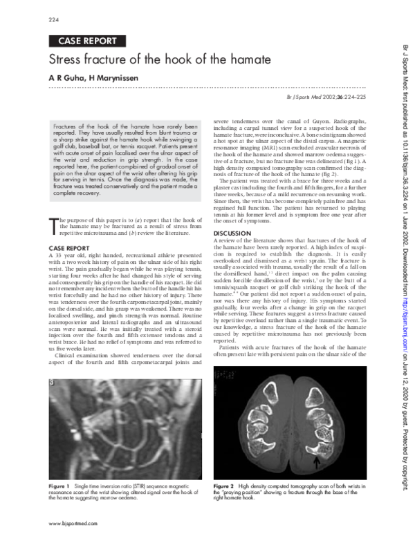 (PDF) Stress fracture of the hook of the hamate