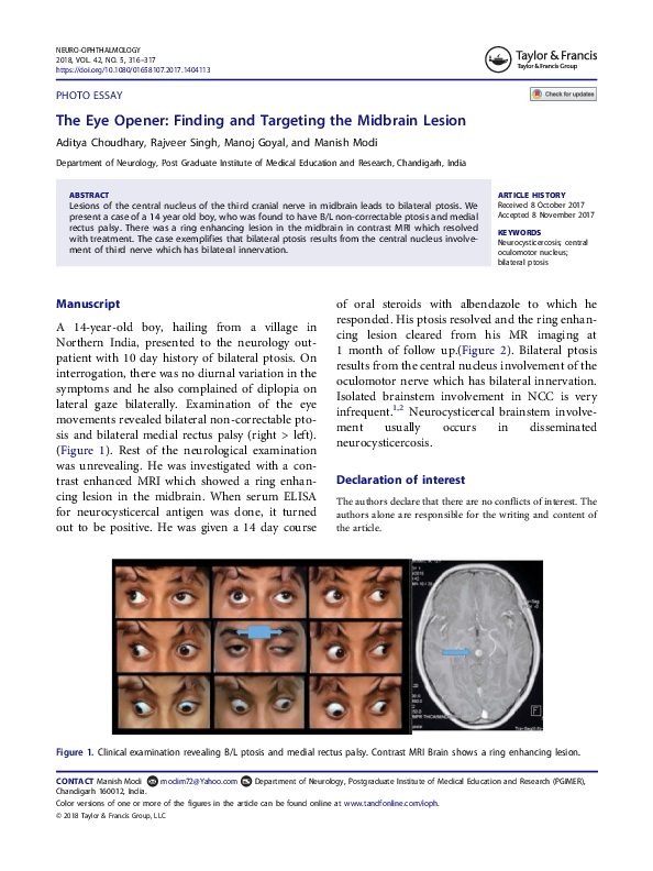 (PDF) The Eye Opener: Finding and Targeting the Midbrain Lesion