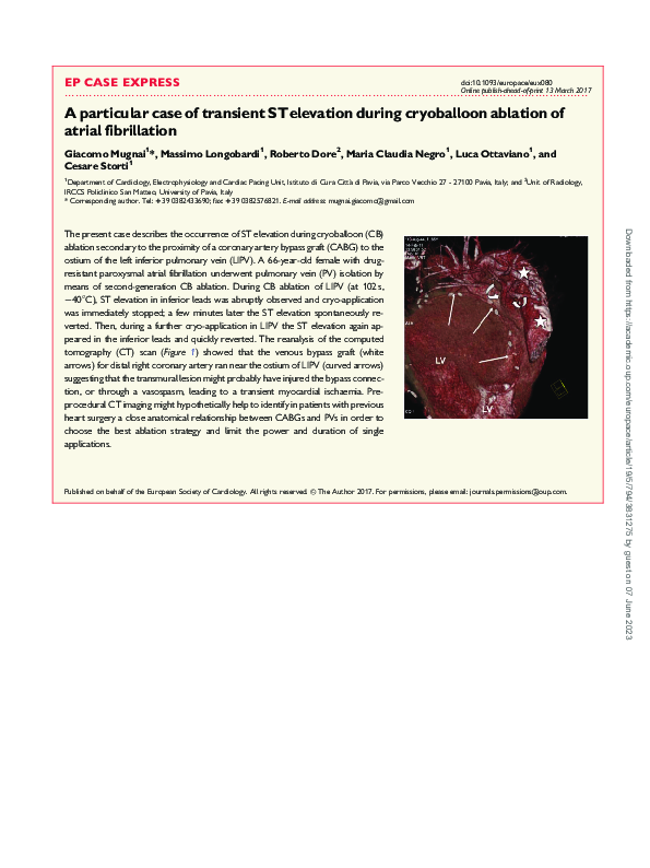 (PDF) A particular case of transient ST elevation during cryoballoon ...