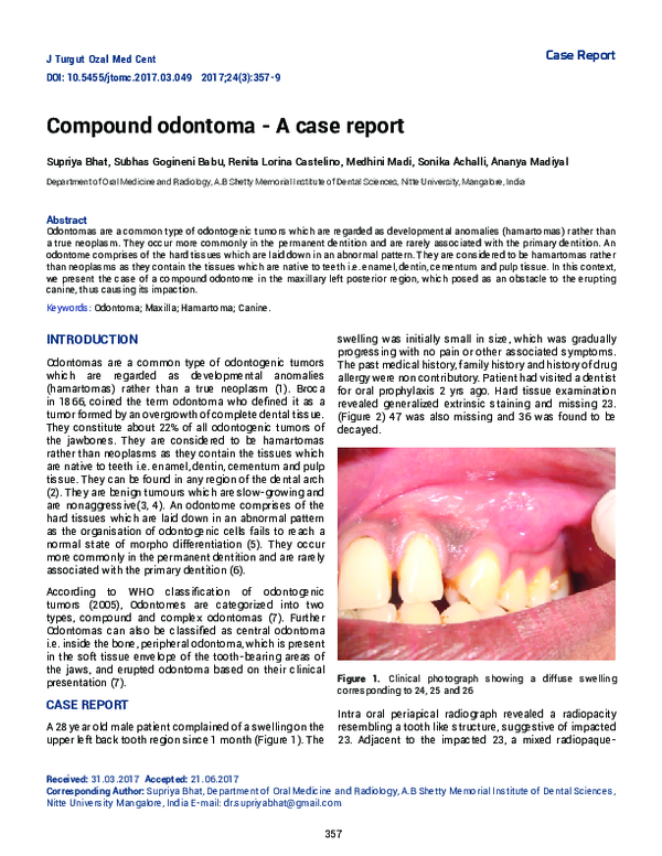 (PDF) Compound odontoma - A case report
