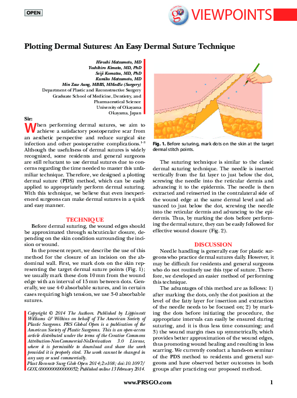 (PDF) Plotting dermal sutures: an easy dermal suture technique | U Min ...