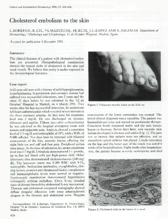 (PDF) Cholesterol embolism to the skin