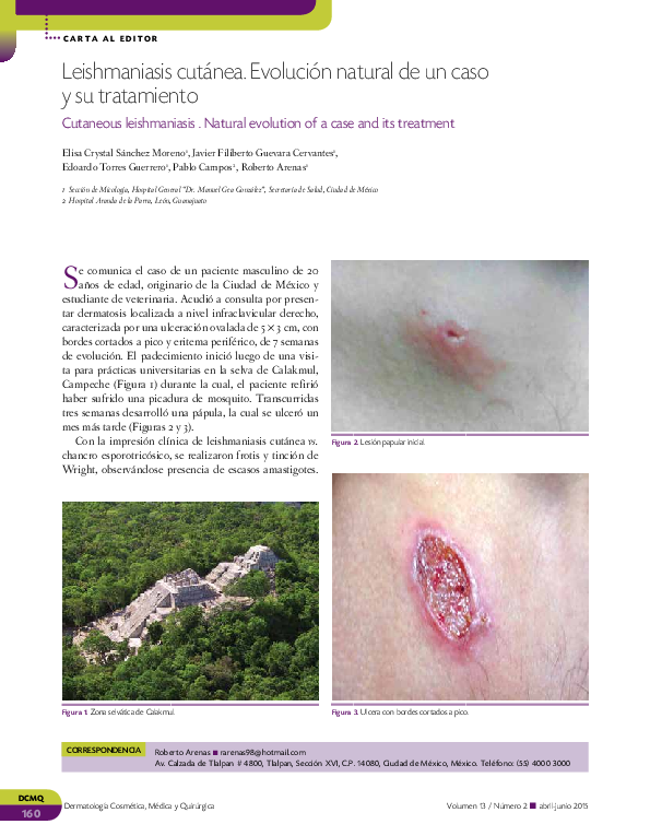 (PDF) Leishmaniasis cutánea. Evolución natural de un caso y su tratamiento