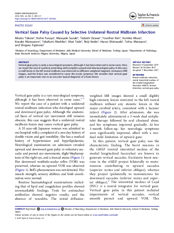 (PDF) Vertical Gaze Palsy Caused by Selective Unilateral Rostral ...