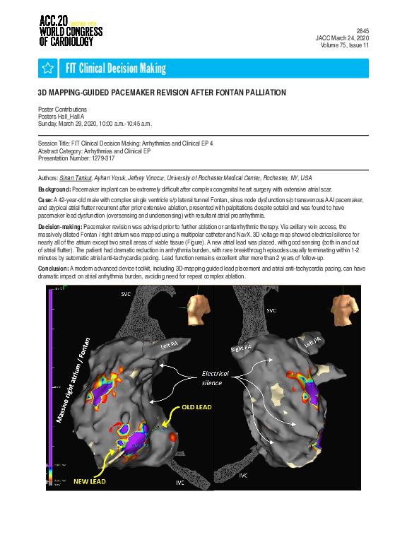 (PDF) 3D Mapping-Guided Pacemaker Revision After Fontan Palliation