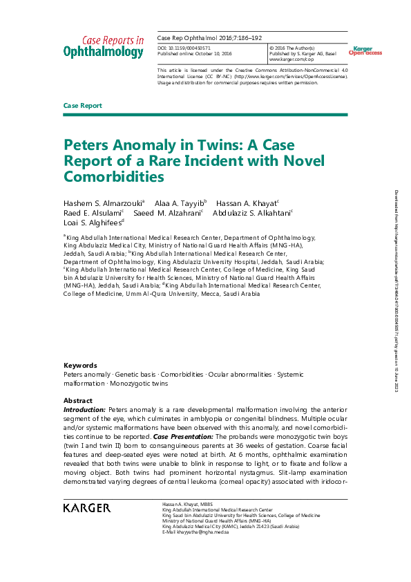 (PDF) Peters Anomaly in Twins: A Case Report of a Rare Incident with ...