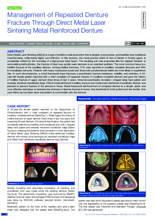 (PDF) Management of Repeated Denture Fracture Through Direct Metal ...