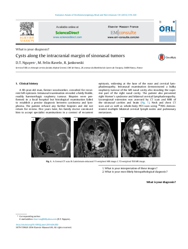 (PDF) Cysts along the intracranial margin of sinonasal tumors | Roger JANKOWSKI - Academia.edu