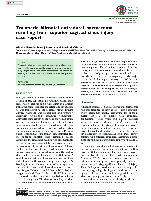 (PDF) Traumatic bifrontal extradural haematoma resulting from superior ...