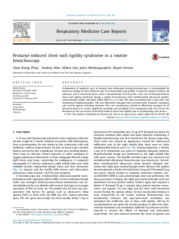 (PDF) Fentanyl-induced chest wall rigidity syndrome in a routine ...