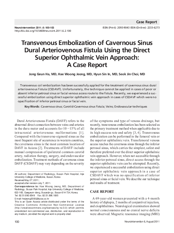 (PDF) Transvenous Embolization of Cavernous Sinus Dural Arteriovenous Fistula Using the Direct ...