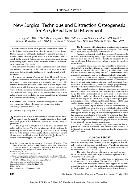 (PDF) Surgical Technique for Ankylosed Tooth Movement