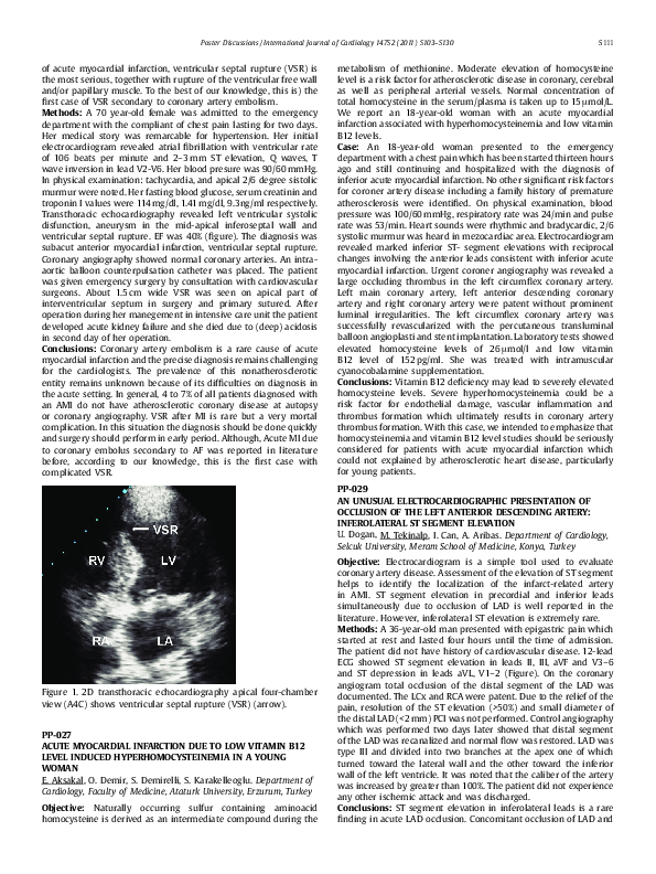 (PDF) PP-029: An Unusual Electrocardiographic Presentation of Occlusion ...