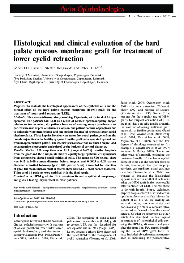 (PDF) Hard Palate Graft for Lower Eyelid Retraction