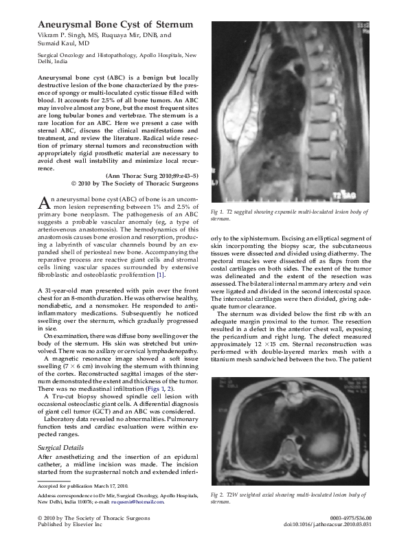 (PDF) Aneurysmal Bone Cyst of Sternum