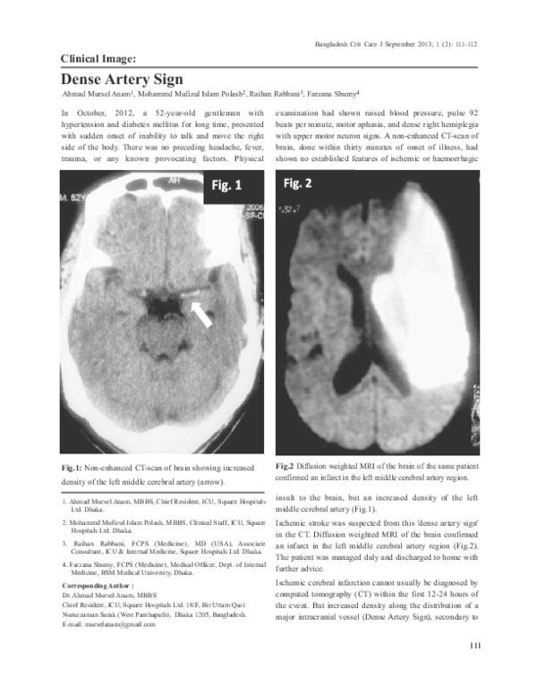 (PDF) Dense Artery Sign