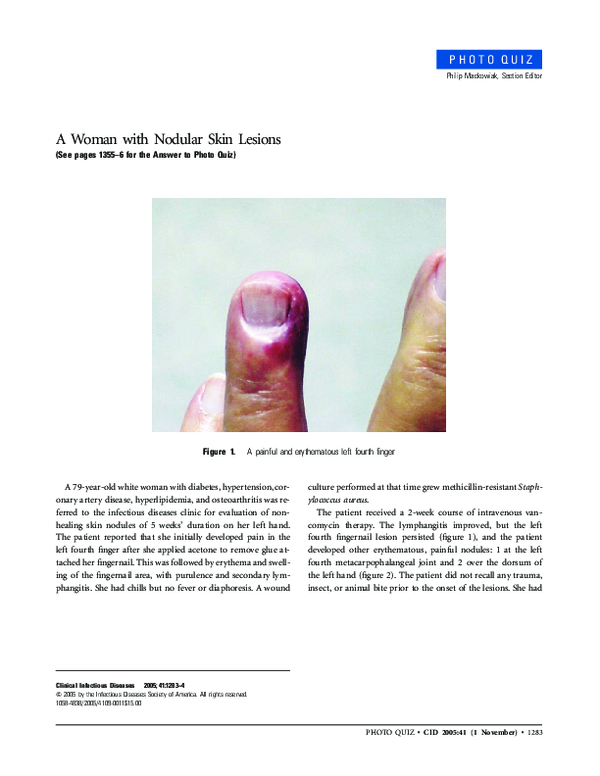 Pdf A Woman With Nodular Skin Lesions Mustafa M Saad