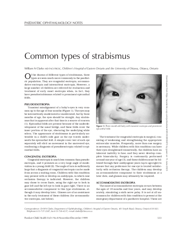 (PDF) Common types of strabismus