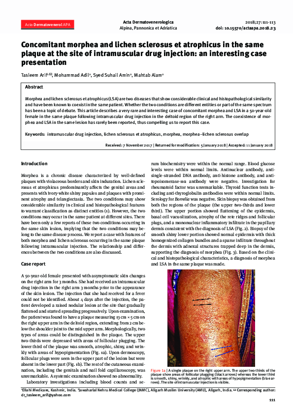 (PDF) Concomitant morphea and lichen sclerosus et atrophicus in the ...