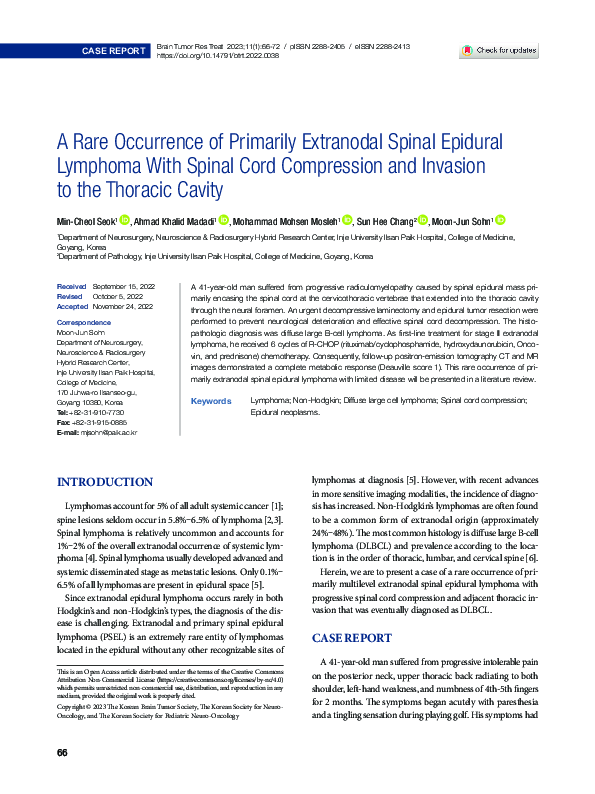 A Rare Occurrence of Primarily Extranodal Spinal Epidural Lymphoma With ...