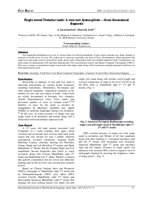 (PDF) Single rooted Posterior teeth: A rare root dysmorphism – three ...