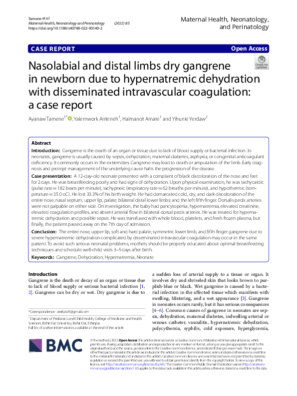 (PDF) Nasolabial and distal limbs dry gangrene in newborn due to ...