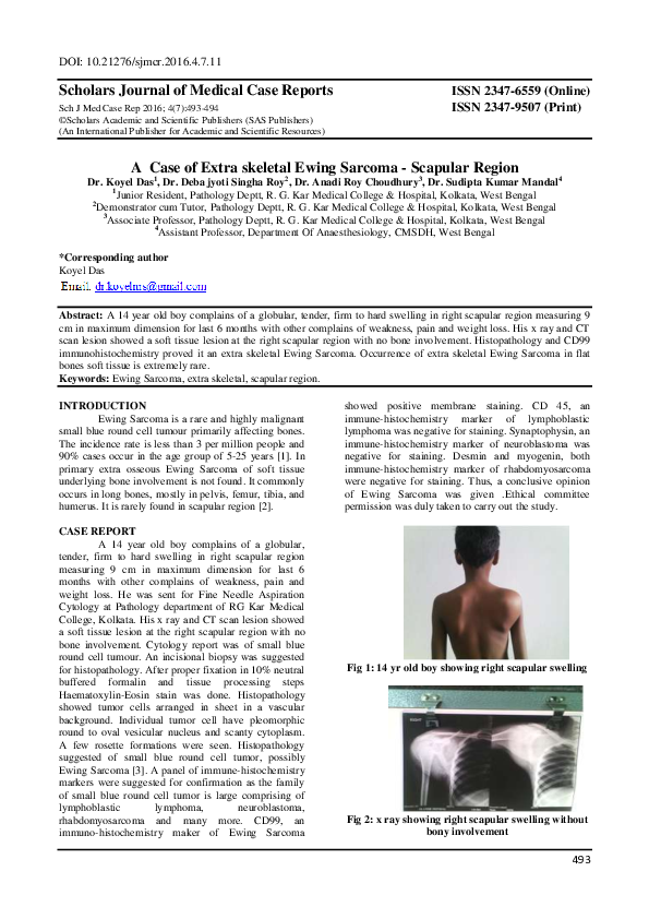 (PDF) A Case of Extra skeletal Ewing Sarcoma – Scapular Region