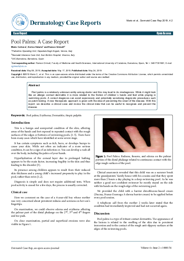 (PDF) Pool Palms: A Case Report
