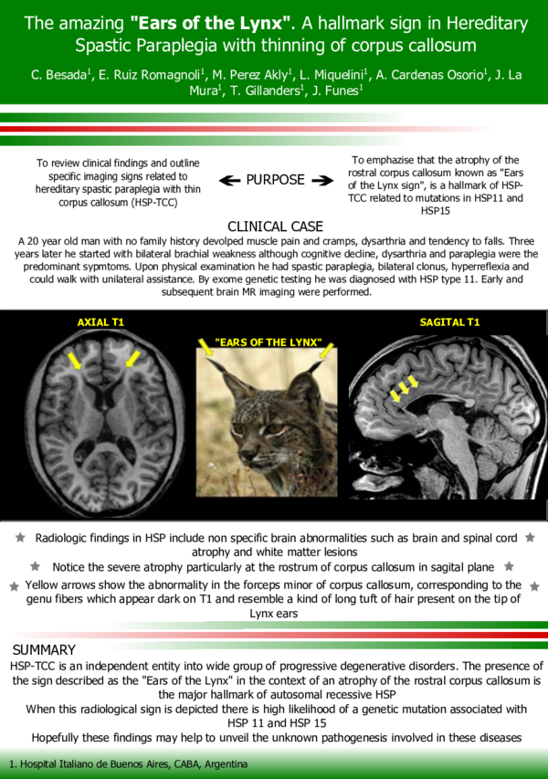 (PDF) The Amazing 'Ears of the Linx' . A Hallmark Sign in Hereditary ...