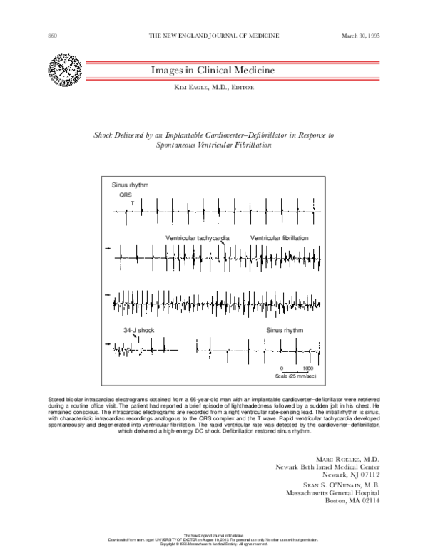 (PDF) Shock Delivered by an Implantable Cardioverter–Defibrillator in ...