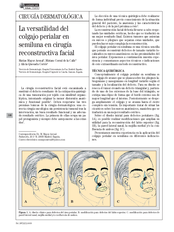 (PDF) La versatilidad del colgajo perialar en semiluna en cirugía ...