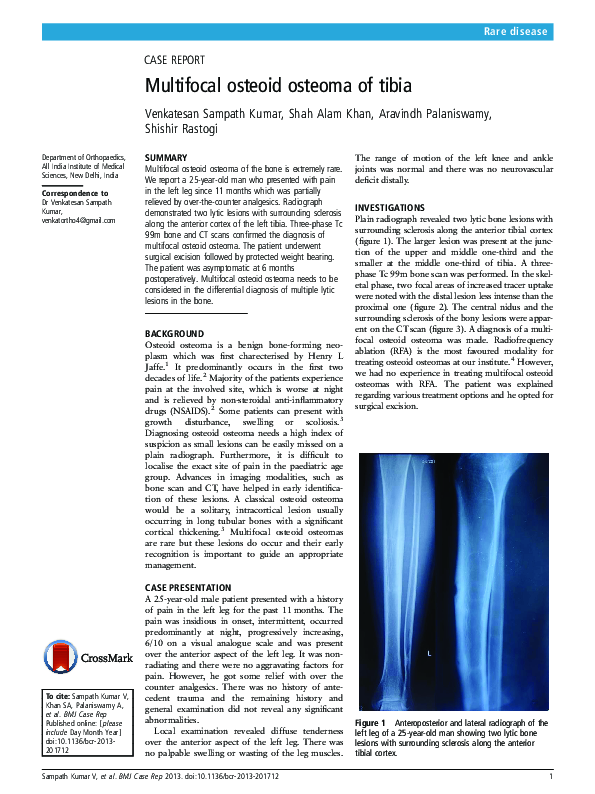 (PDF) Multifocal osteoid osteoma of tibia