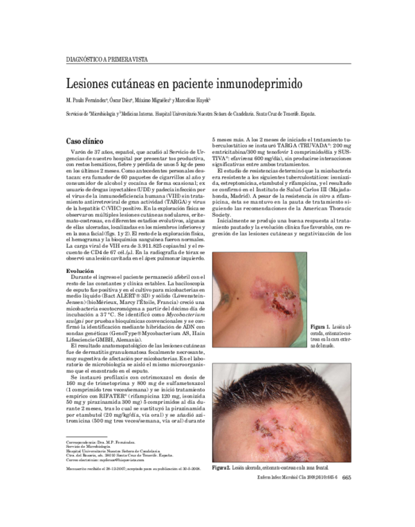 (PDF) Lesiones cutáneas en paciente inmunodeprimido