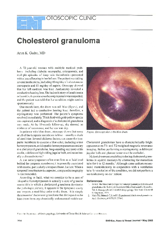 (PDF) Cholesterol Granuloma