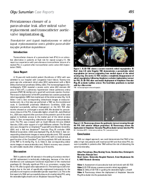 (PDF) Percutaneous closure of a paravalvular leak after mitral valve ...