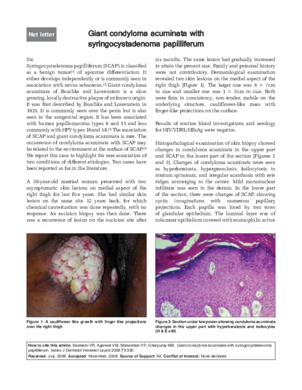 (PDF) Giant condyloma acuminata with syringocystadenoma papilliferum