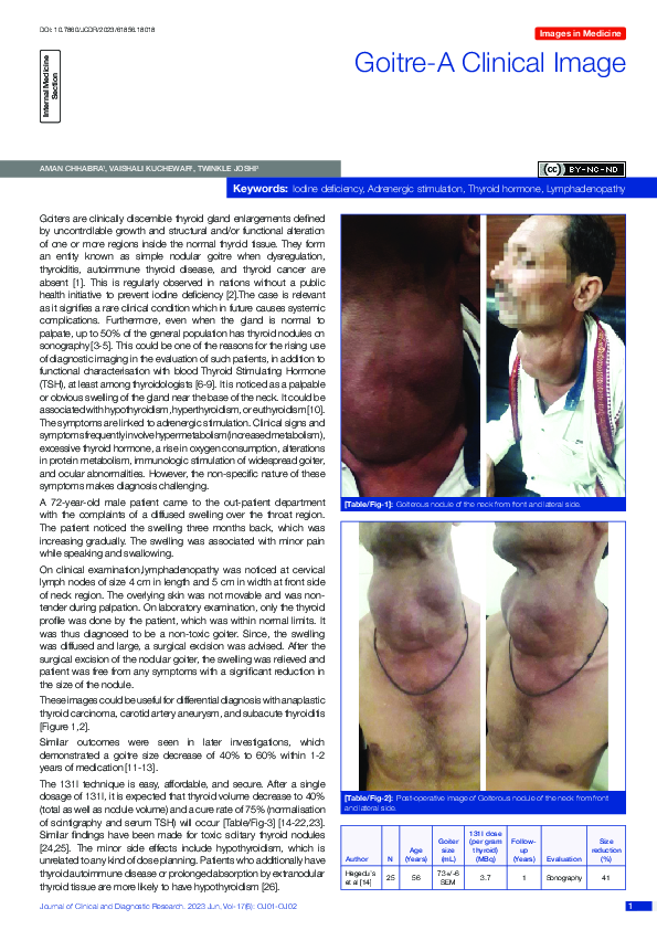(PDF) Goitre-A Clinical Image | Dr. Aman Chhabra - Academia.edu