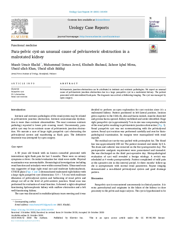(PDF) Para-pelvic cyst-an unusual cause of pelviureteric obstruction in ...