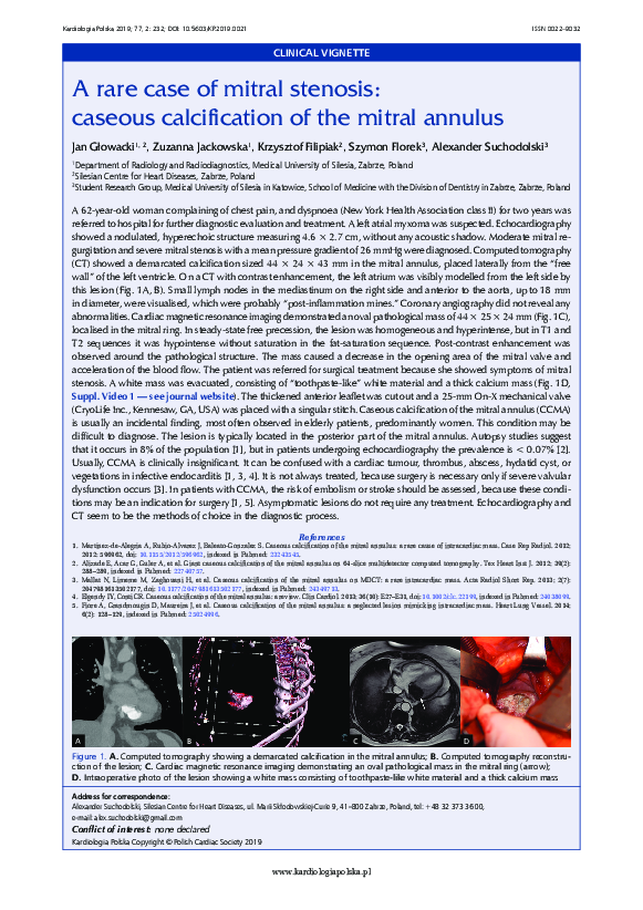 (PDF) A rare case of mitral stenosis: caseous calcification of the ...
