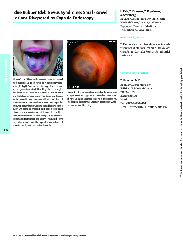 (PDF) Blue Rubber Bleb Nevus Syndrome: Small-Bowel Lesions Diagnosed by ...