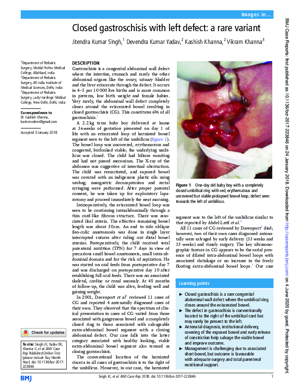 (PDF) Closed gastroschisis with left defect: a rare variant