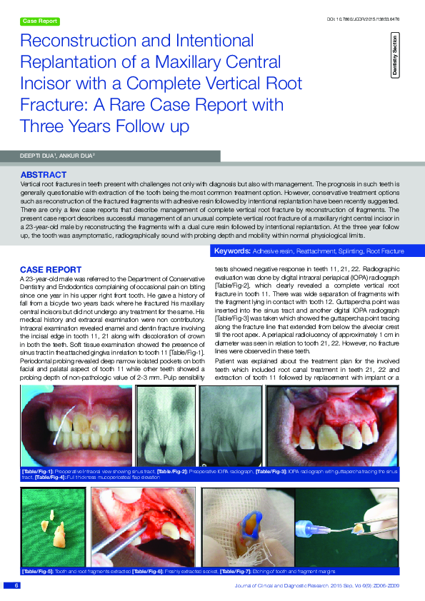 (PDF) Reconstruction and Intentional Replantation of a Maxillary Central Incisor with A Complete ...