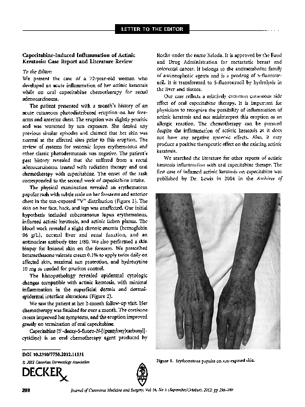 (PDF) Capecitabine-Induced Inflammation of Actinic Keratosis: Case ...