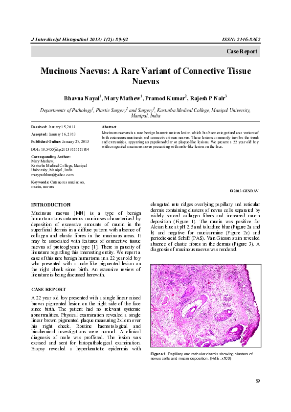 (PDF) Mucinous Naevus: A Rare Variant of Connective Tissue Naevus ...