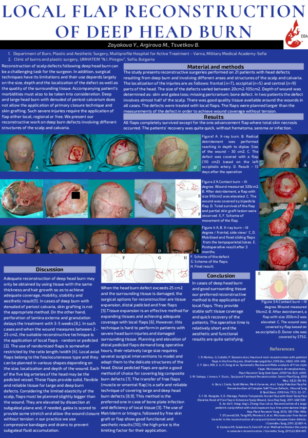(PDF) 2 - Local Flap Reconstruction of Deep Head Burn