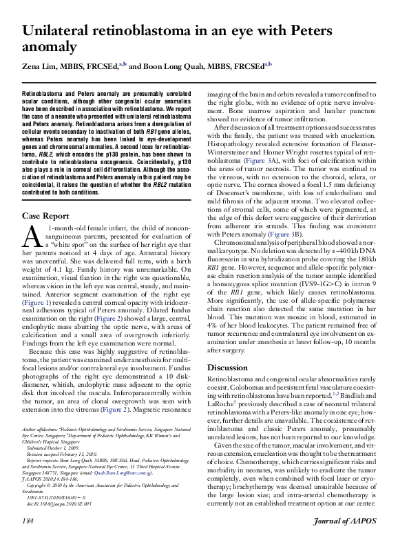 (PDF) Unilateral retinoblastoma in an eye with Peters anomaly
