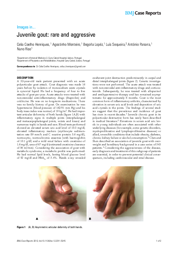(PDF) Juvenile gout: rare and aggressive