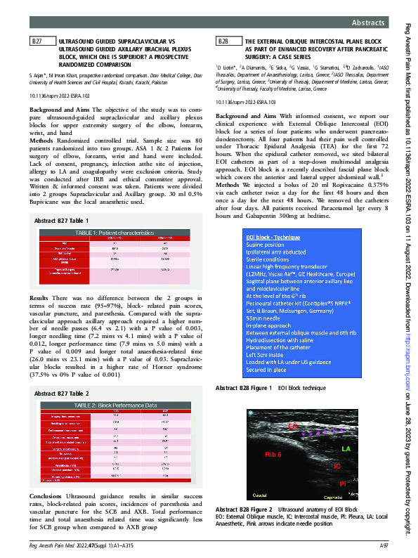 (PDF) B28 The external oblique intercostal plane block as part of ...
