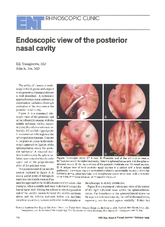 (PDF) Endoscopic View of the Posterior Nasal Cavity
